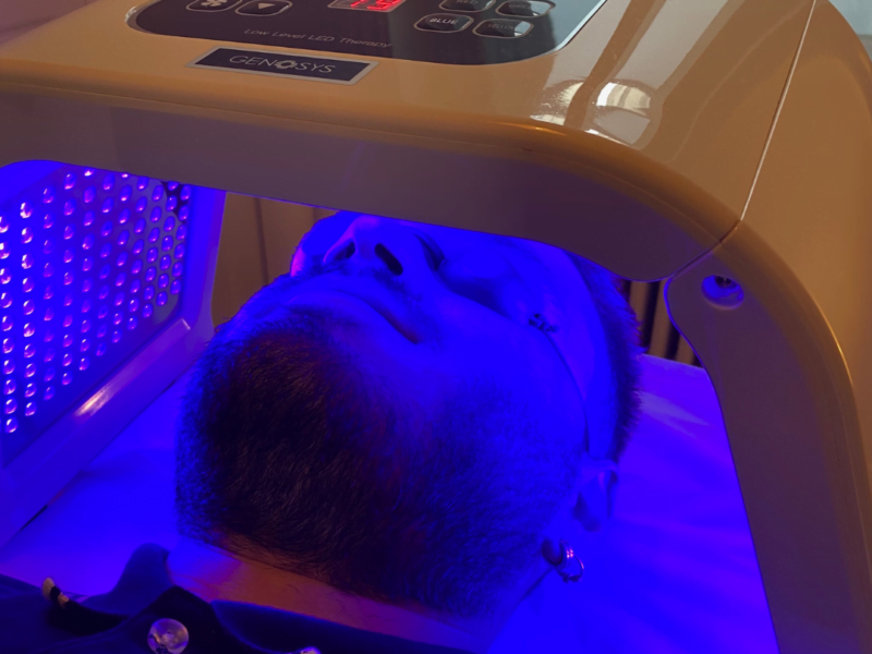 Zoom sur l’acide hyaluronique - Alfa Laser Center - Blog