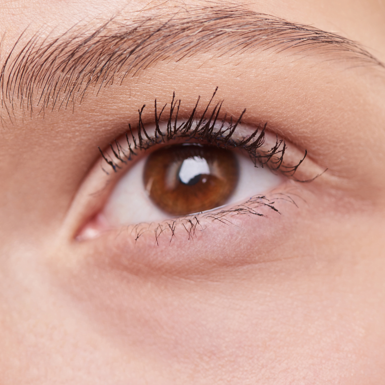 Traiter ses cernes, c’est possible ! - Alfa Laser Center - Blog