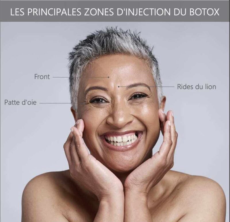 Les 7 choses indispensables à savoir sur l’injection de Botox à Annecy ...